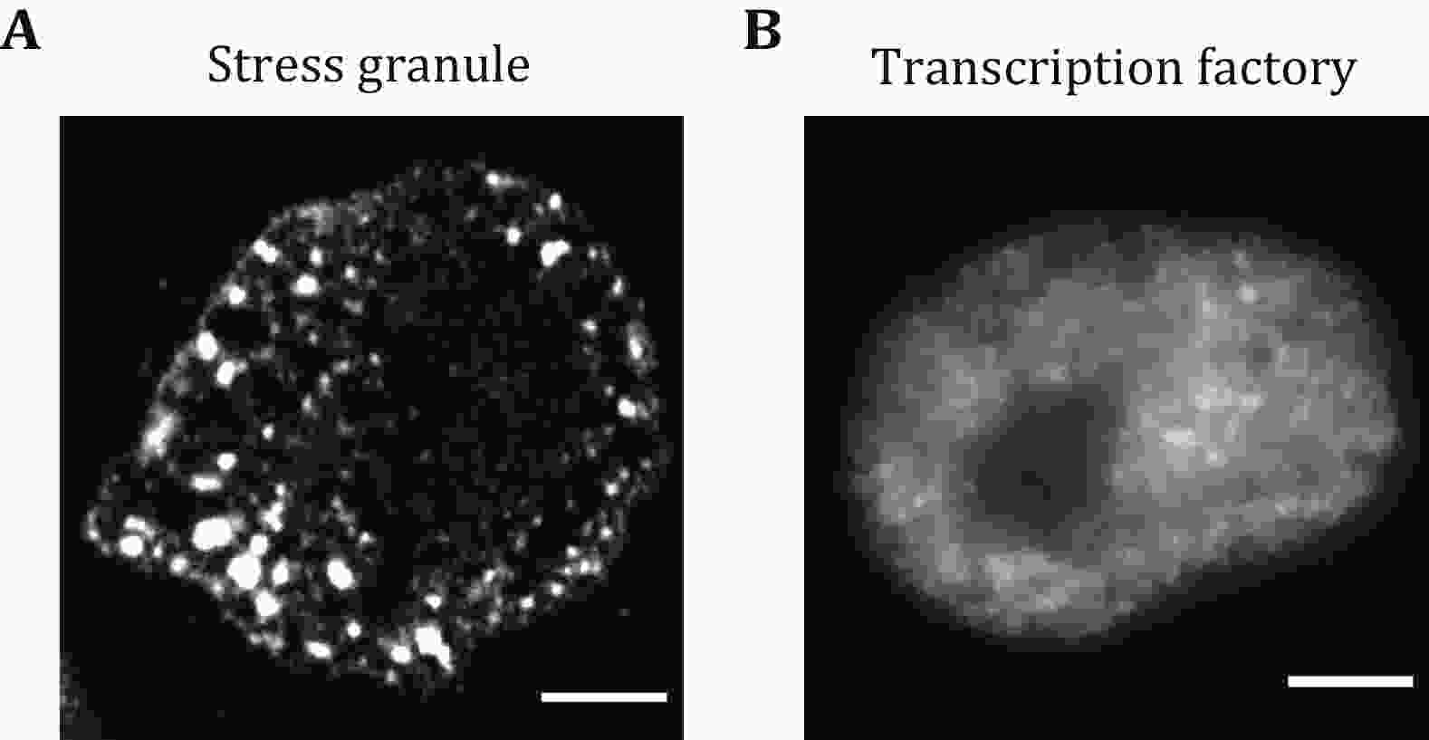 Characterization of liquid–liquid phase separation using super ...