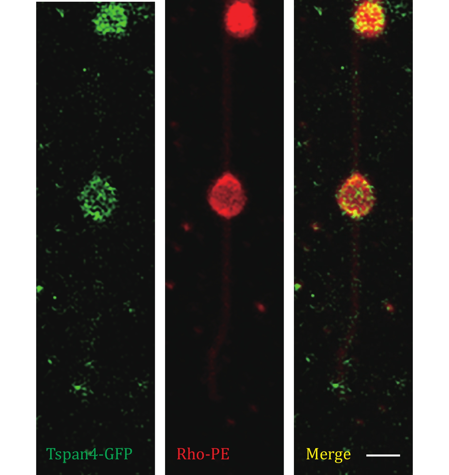 Seeing is believing: observation of migrasomes
